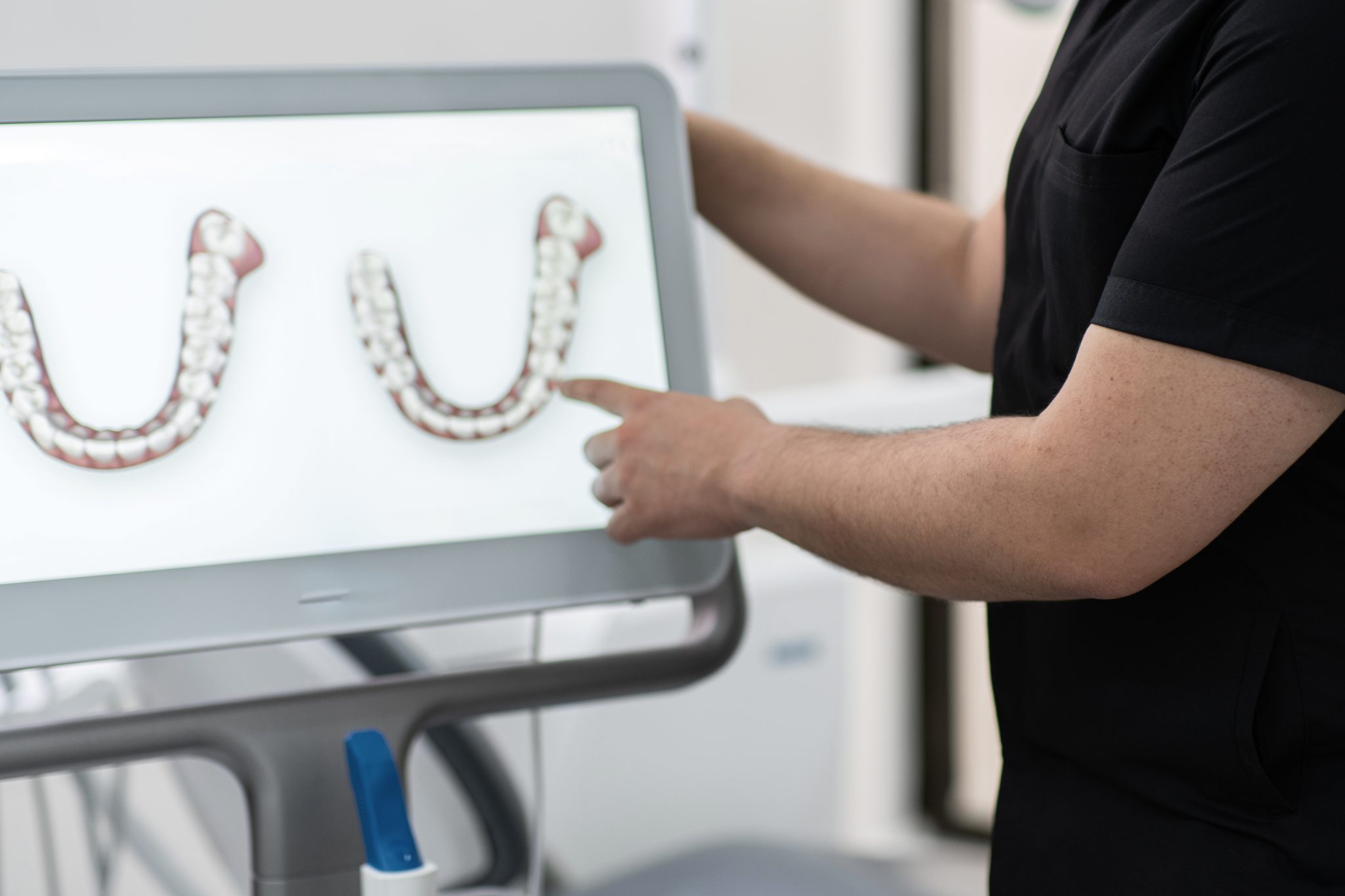 Escaneo intraoral: la revolución digital que sustituye los moldes ...